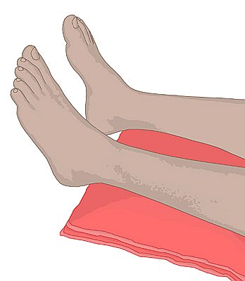 Standard "Hohllagerung der Ferse"